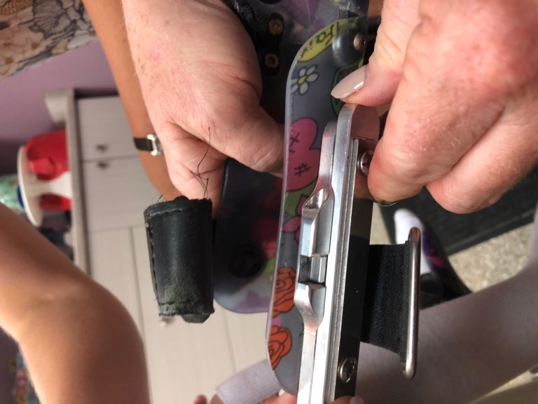 Twister Cables and Ankle Foot Orthosis – Custom Orthotics of London